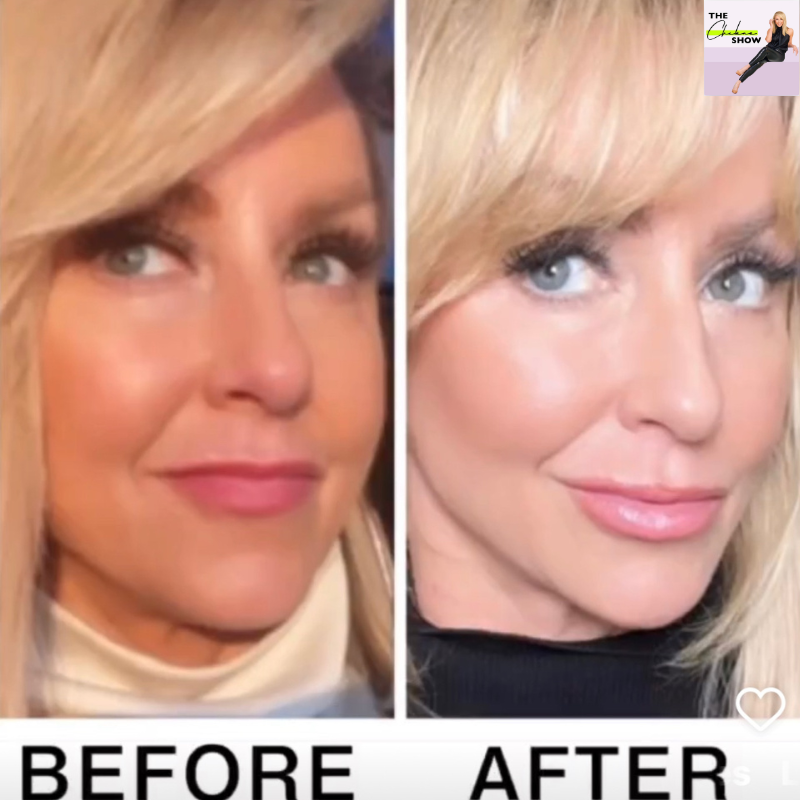 I No Longer Mouth Tape for Sleep - CHALENE JOHNSON